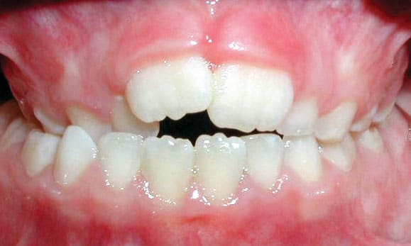 Reasons for Orthodontic Treatment at Kaitlin McClure Orthodontics