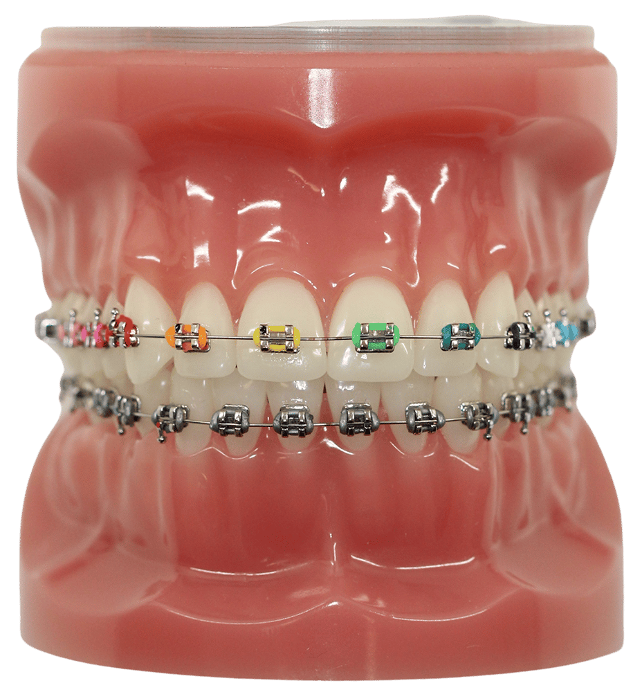 Braces Arcadia, CA | Kaitlin McClure Orthodontics